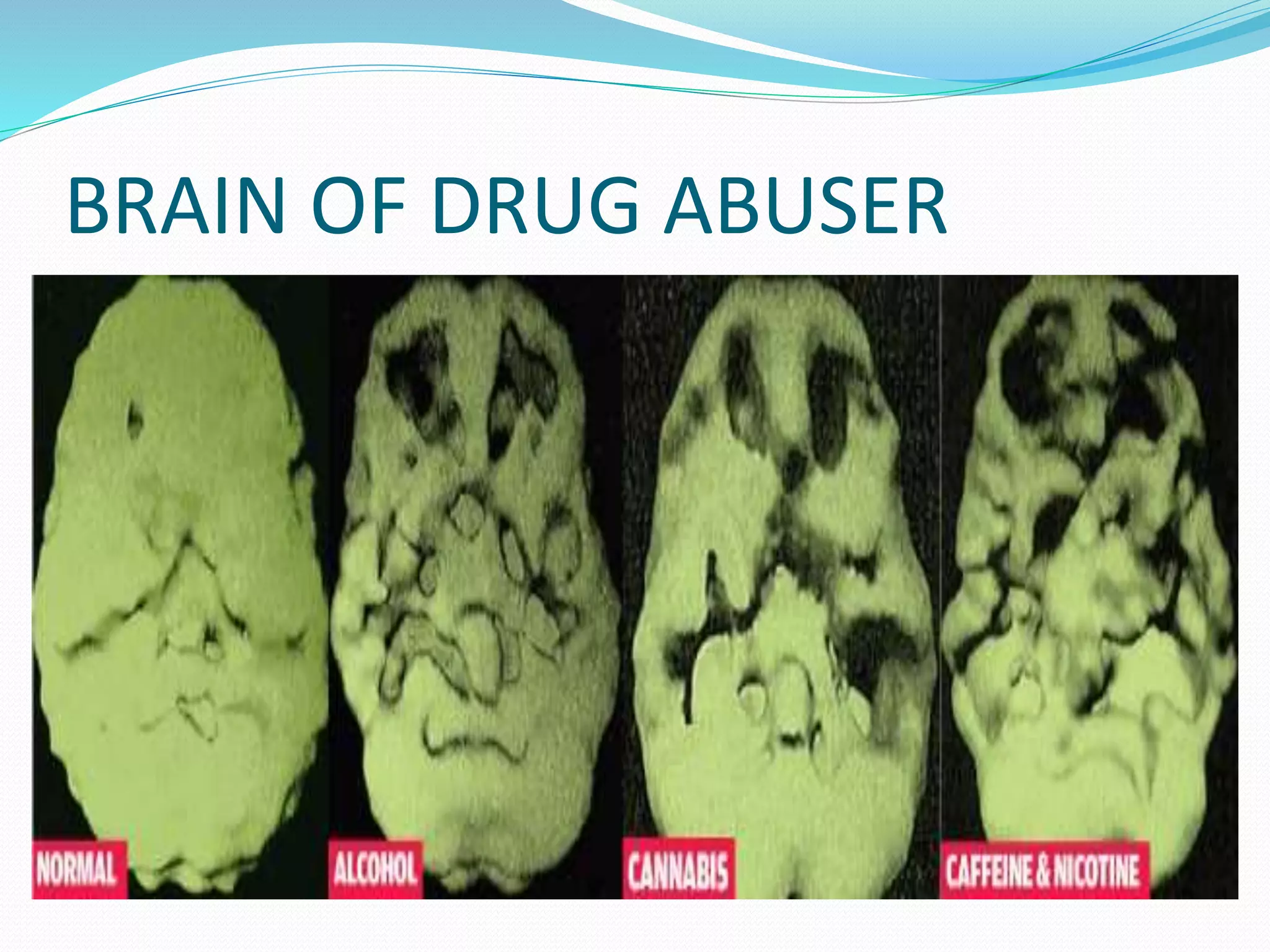 Drug awareness | PPTX