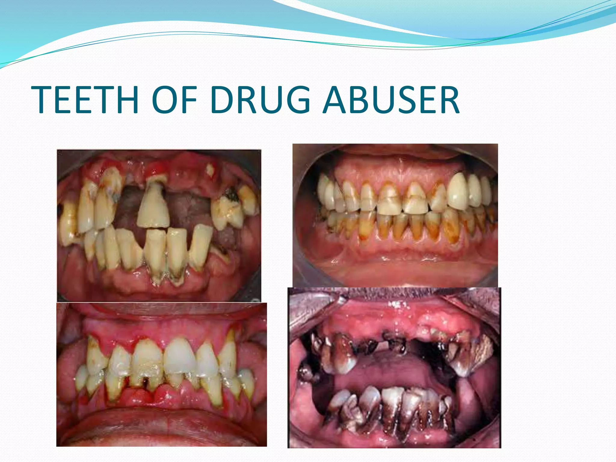 Drug awareness | PPTX