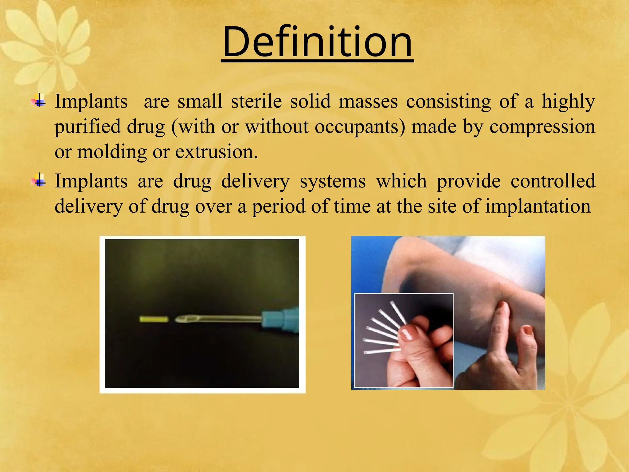 Drug Delivery by Implants in pharmaceutical sciences | PPTX