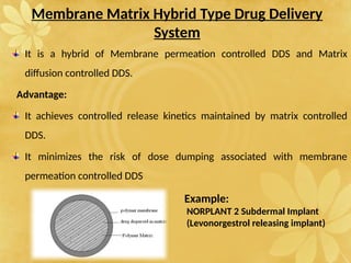Drug Delivery by Implants in pharmaceutical sciences | PPTX