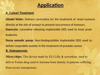 Drug Delivery by Implants in pharmaceutical sciences | PPTX