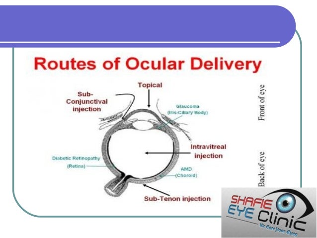 Drug delivery&contact lens