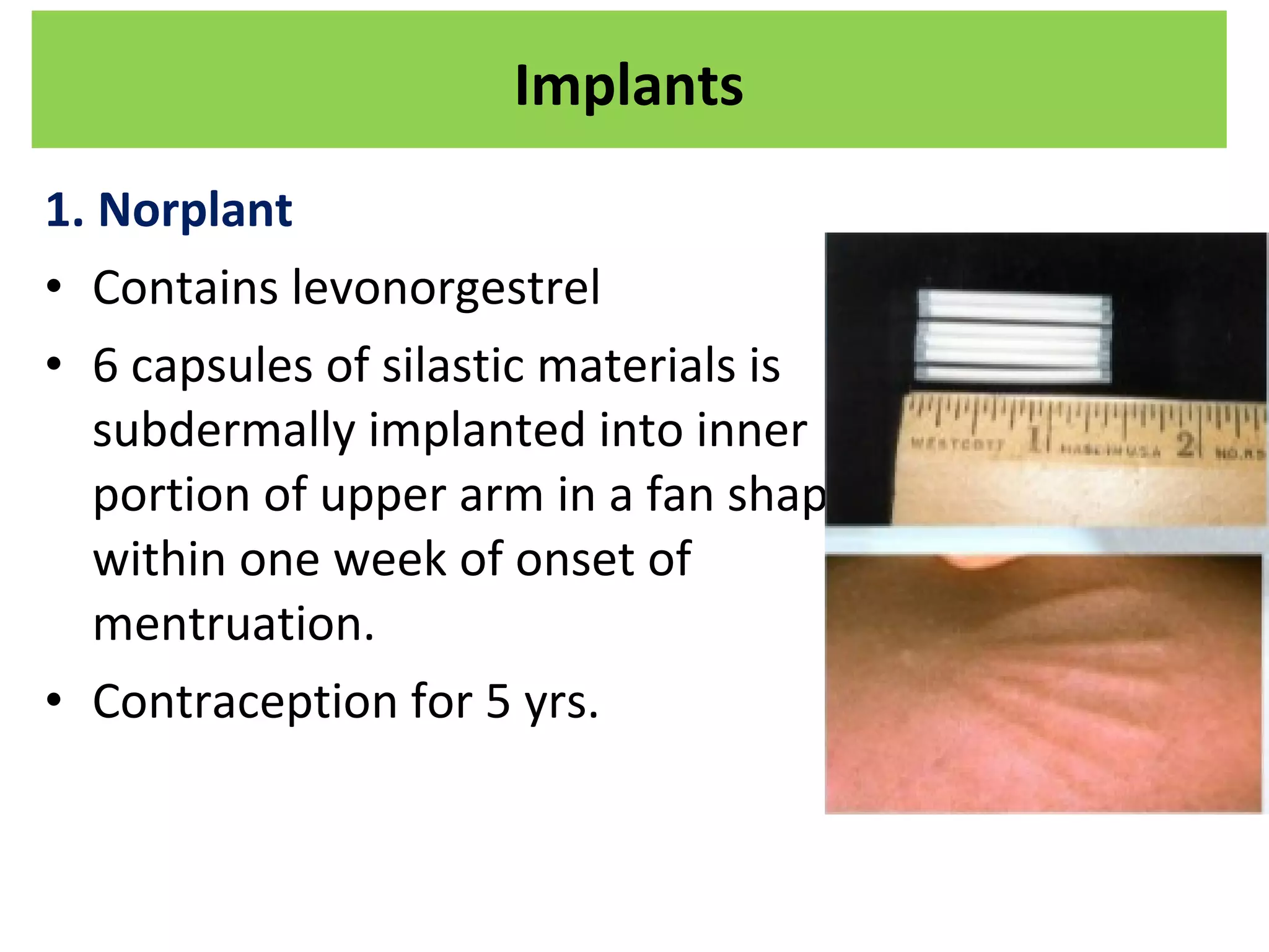Drug delivery systems | PPT