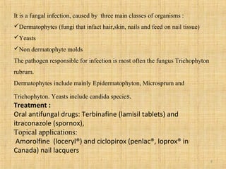 Drug delivery to nail | PPT