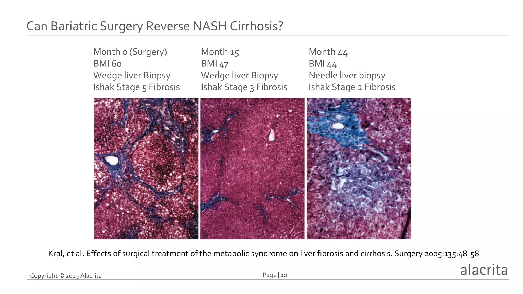 Drug Development in Nash Cirrhosis by Dr. Peter G. Traber, Sept 2019 | PDF