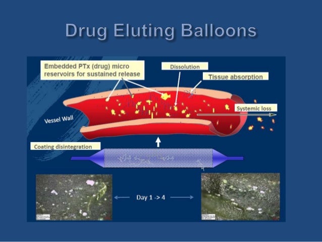 Drug eluting balloons for critical limb ischaemia (cli)