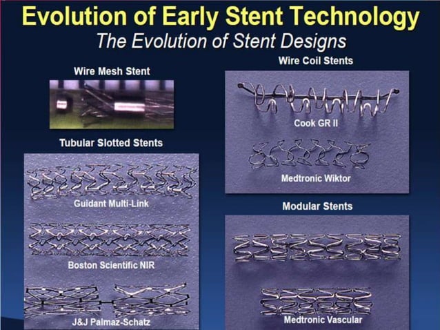 Drug eluting stent | PPT