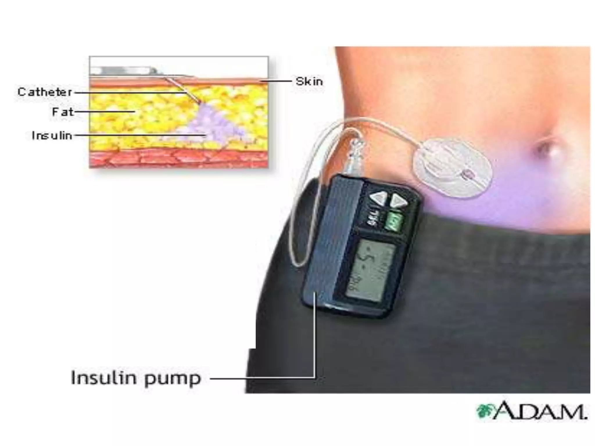 Drug formulations, dosage form and drug delivery devices | PPTX