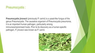 Drug for treatment of pneumocystis | PPTX
