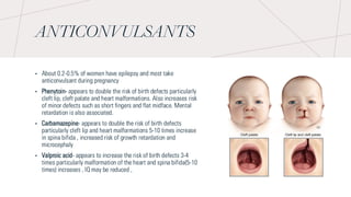Drug Induced Birth Defects by Fauzia Khan | PDF
