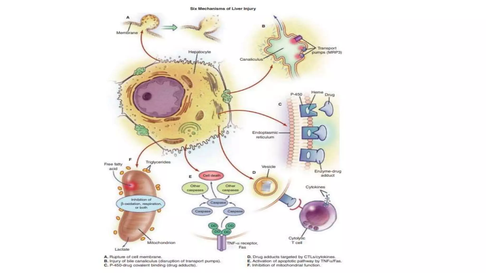 Drug induced liver injury- pathophysiology and causes.pptx