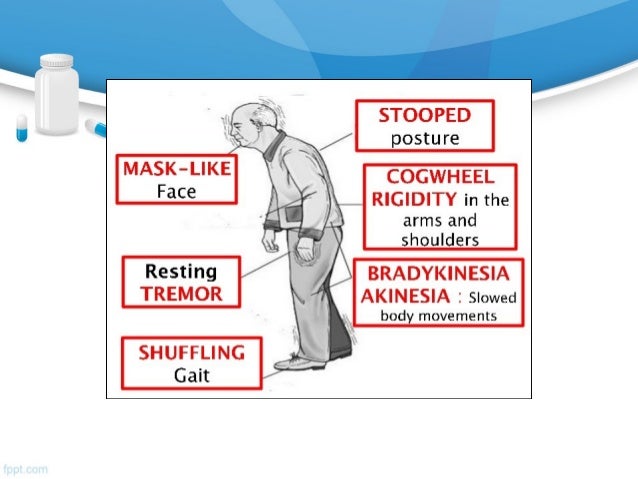 Drug induced movement disorders