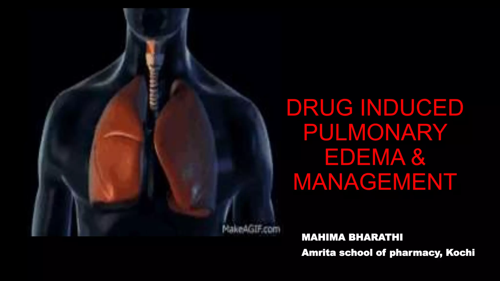 Drug induced pulmonary edema | PPTX