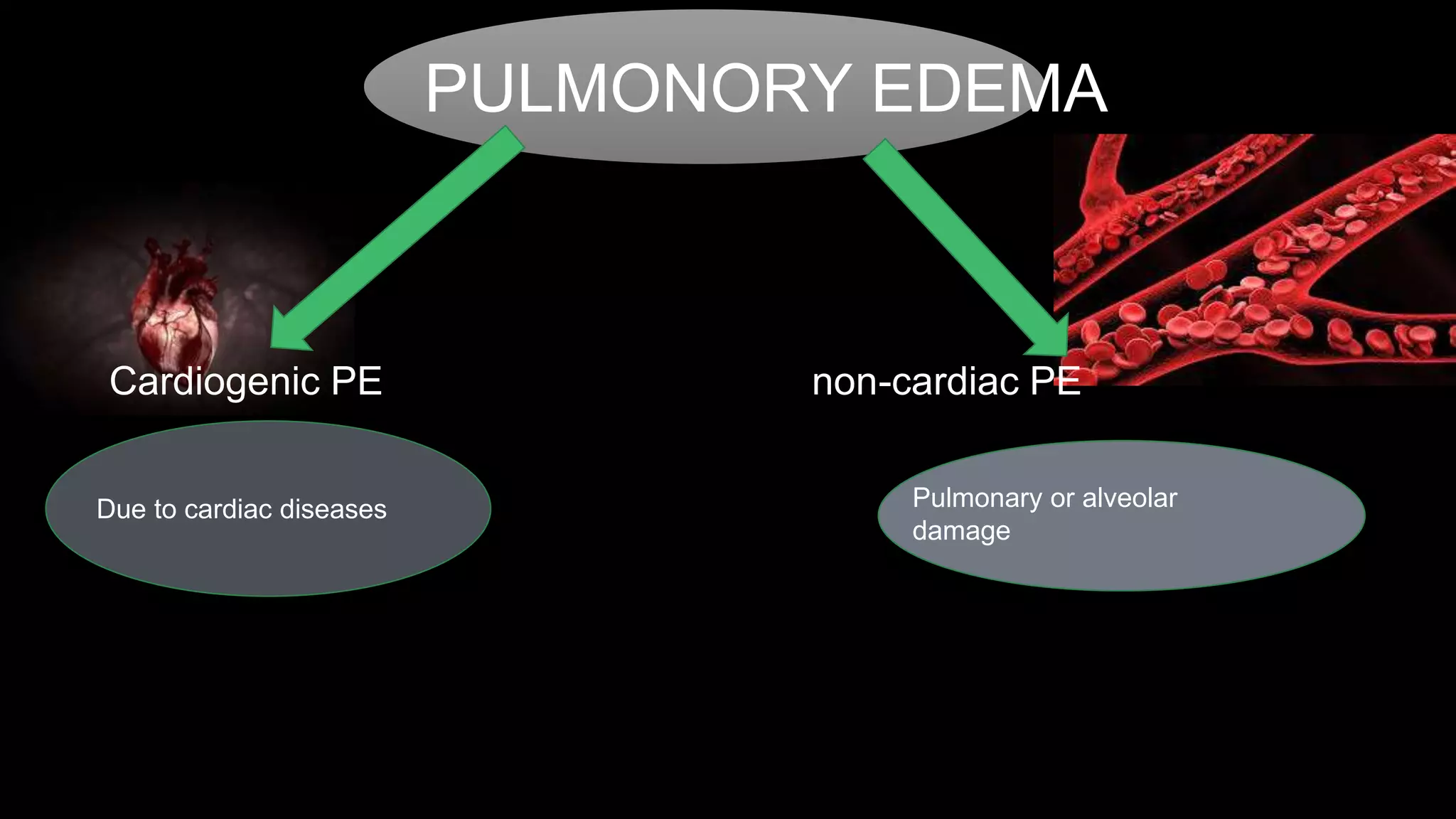 Drug induced pulmonary edema | PPTX