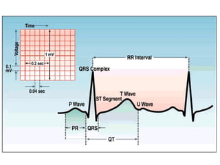 Drug induced QT prolongation | PPT