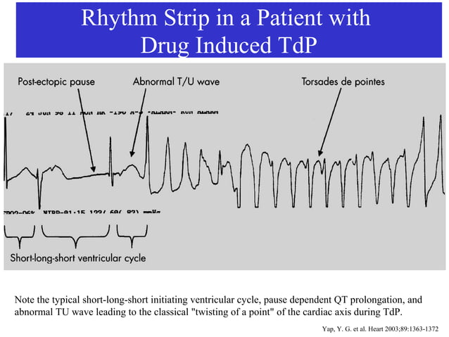 Drug induced QT prolongation | PPT