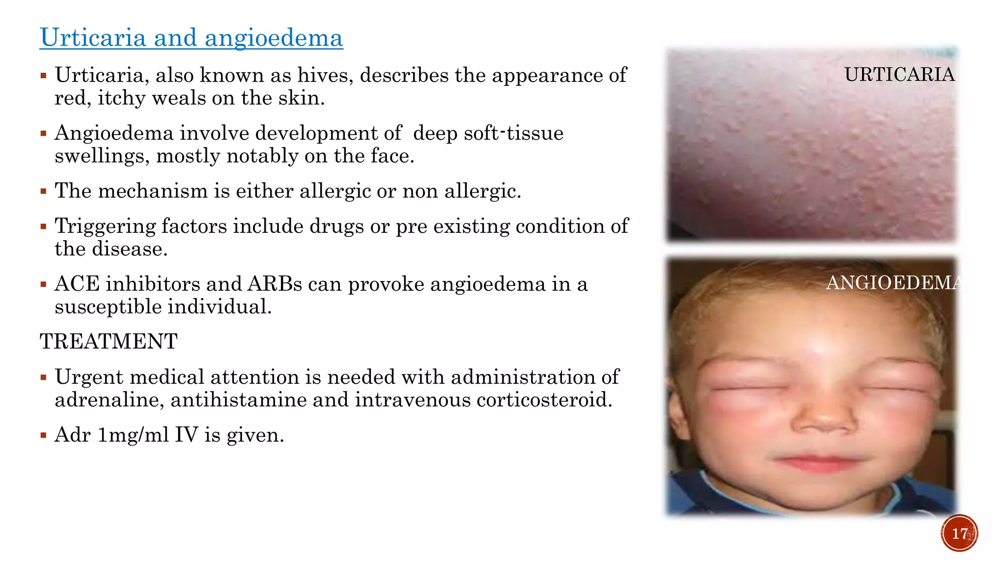 Drug induced skin disorders | PPTX