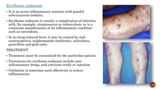 Drug induced skin disorders | PPTX | Allergies | Diseases and Conditions