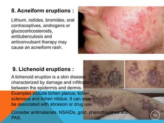 Drug Induced Skin Disorders | PPTX