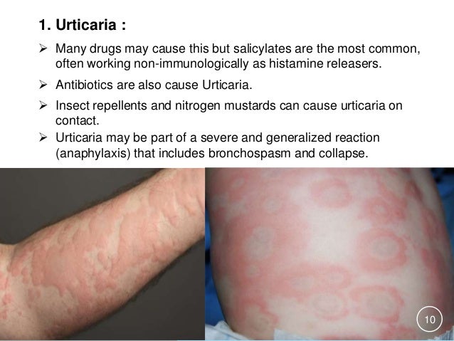 Drug Induced Skin Disorders