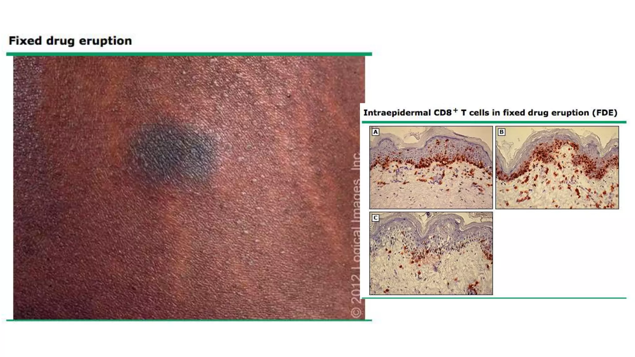 Drug induced skin emergencies | PPTX