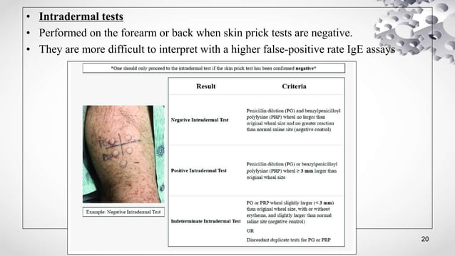 Drug intolerance | PPTX