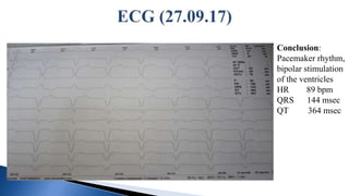 Drug managment of paitent with heart failure after cardiac pacing | PPTX