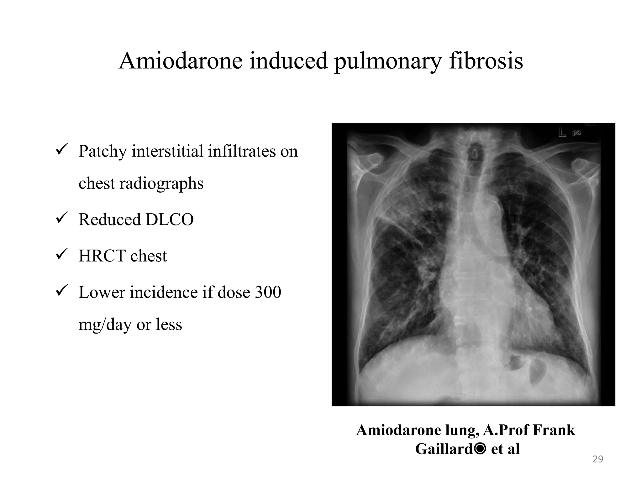 Amiodarone, Drug of the month | PPTX | Thyroid Disorders | Endocrine ...