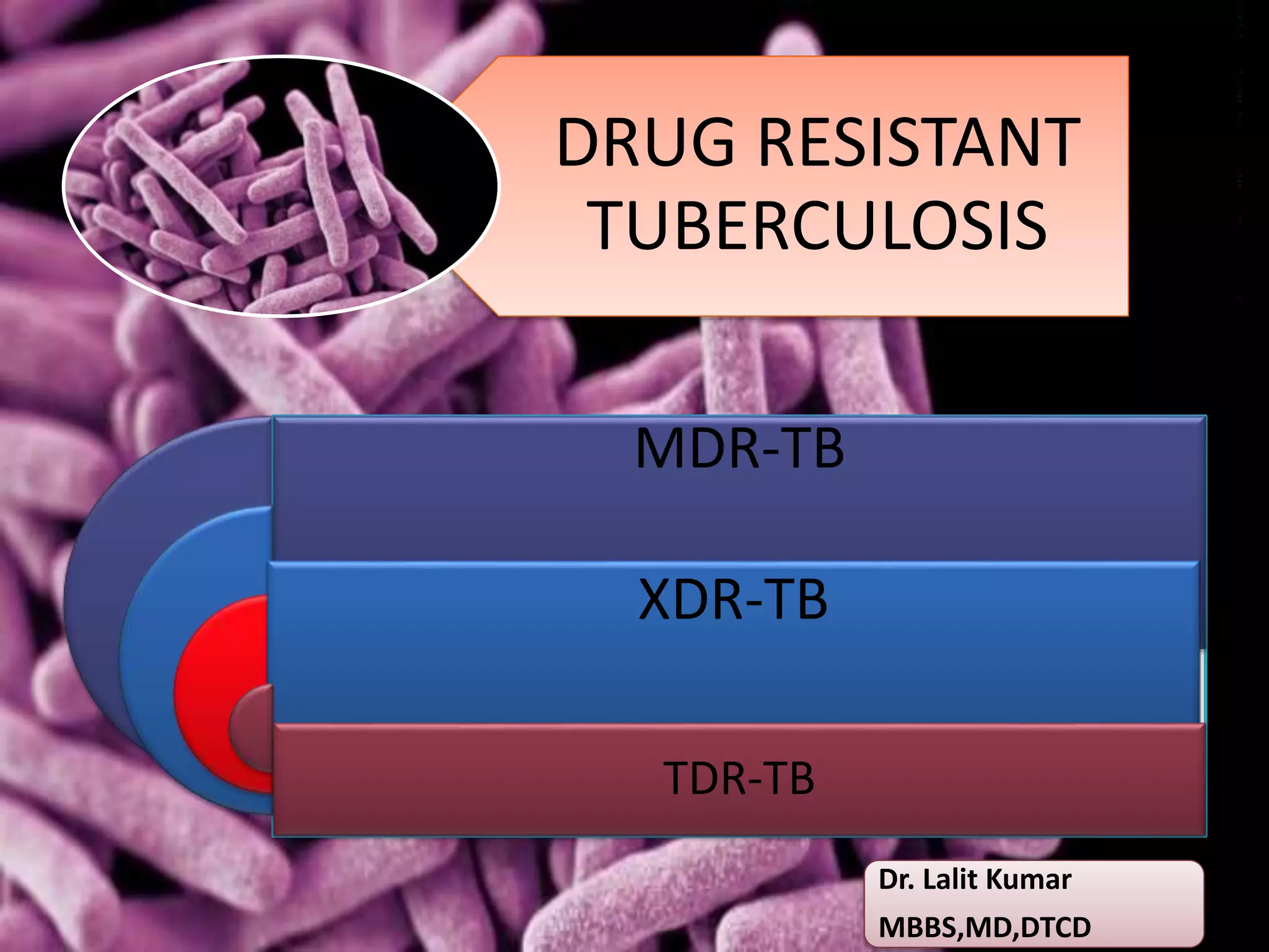 DRUG RESISTANT TUBERCULOSIS,DIAGNOSIS AND TREATMENT | PPTX