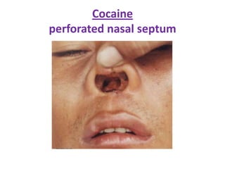 Drugs | PPTX