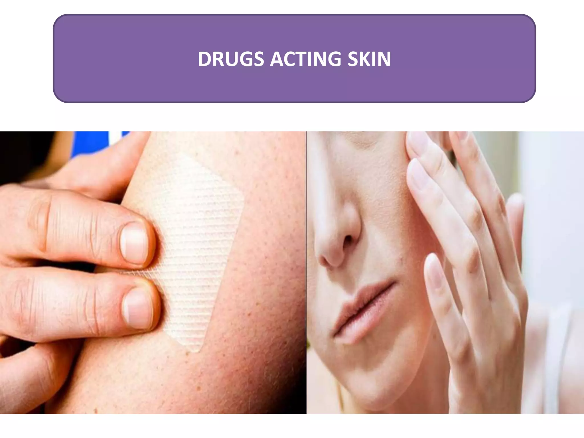 Drugs acting on skin- acne, psoriasis, sclerosing agents, melanizing ...