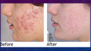 Drugs acting on skin and mucous membranes | PPTX