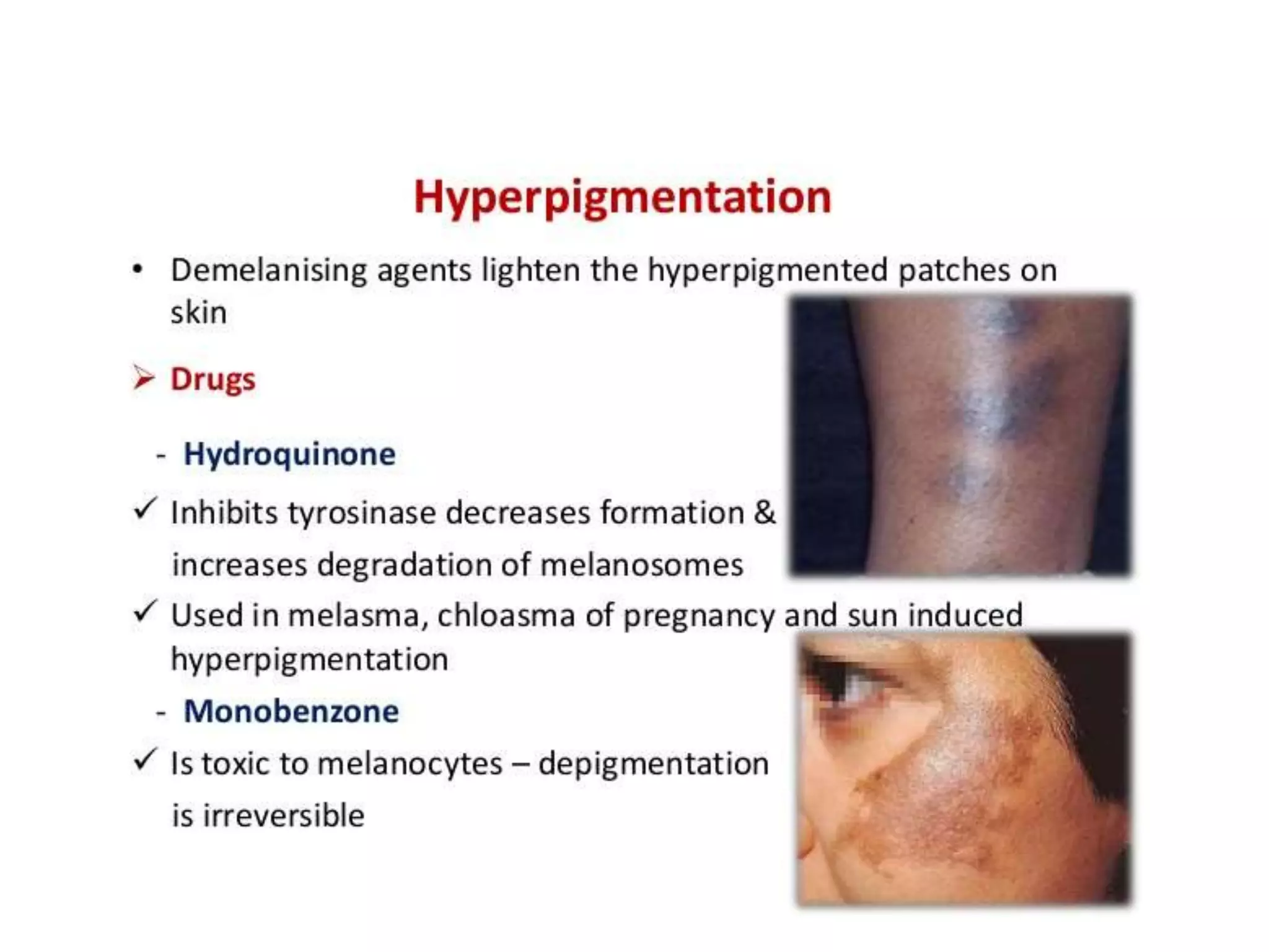 Drugs acting on Skin and Mucous membrane | PPTX