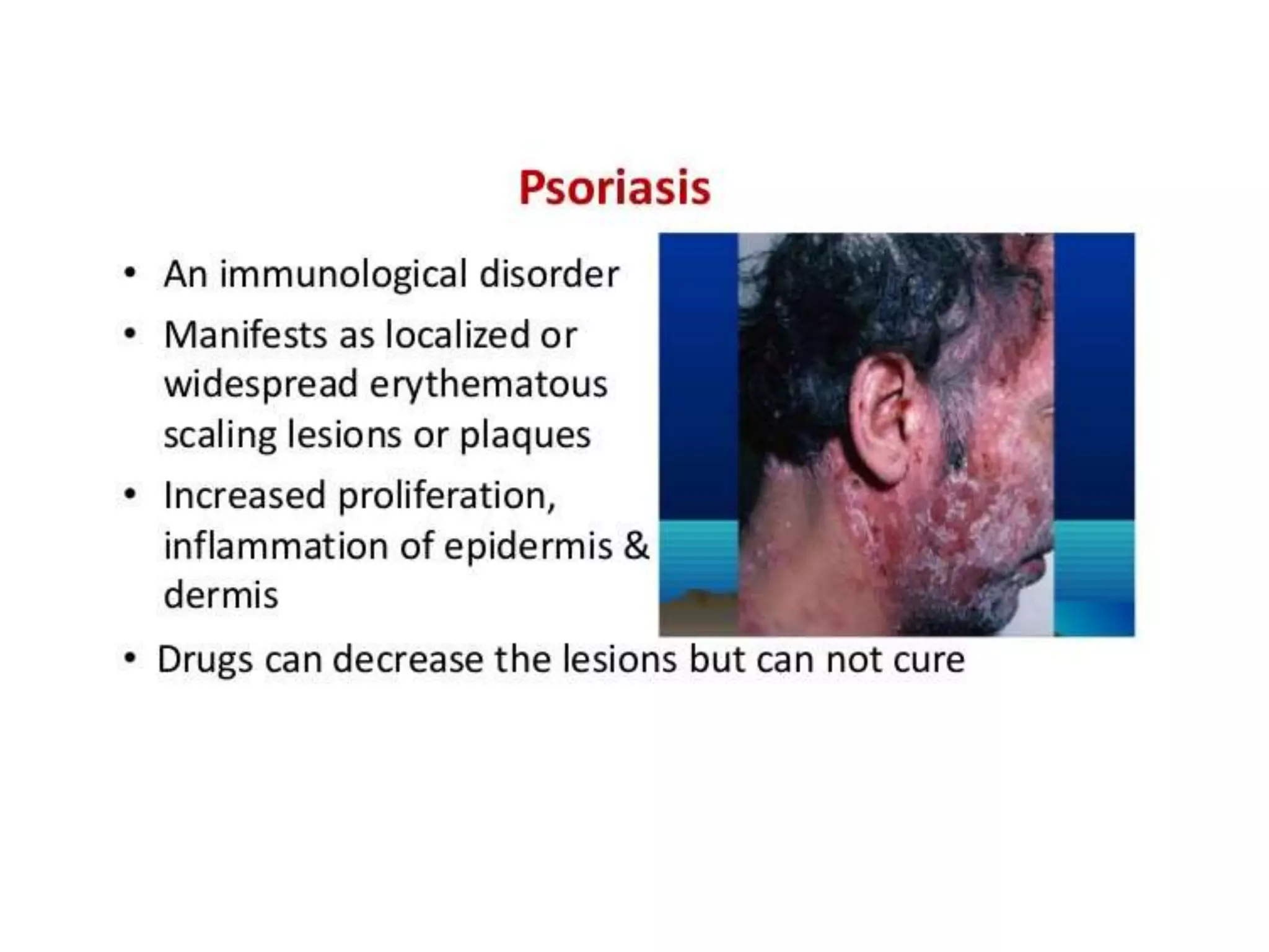 Drugs acting on Skin and Mucous membrane | PPTX