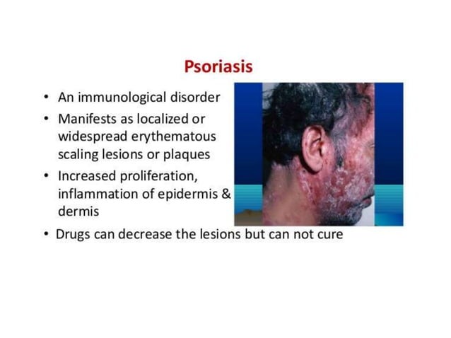 Drugs acting on Skin and Mucous membrane