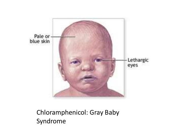 Drug Safety in Pregnancy and Lactation