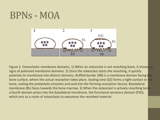 Bisphosphonates - drdhriti | PPTX | Endocrine and Metabolic Diseases ...