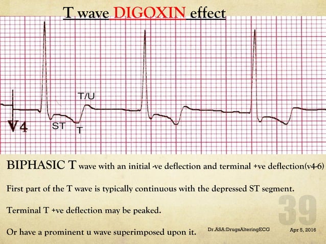 Drugs altering ecg | PPT | Heart and Cardiovascular Diseases | Diseases ...