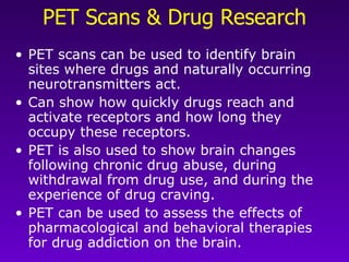 Drugsandthe Brain Part2 Addiction | PPT