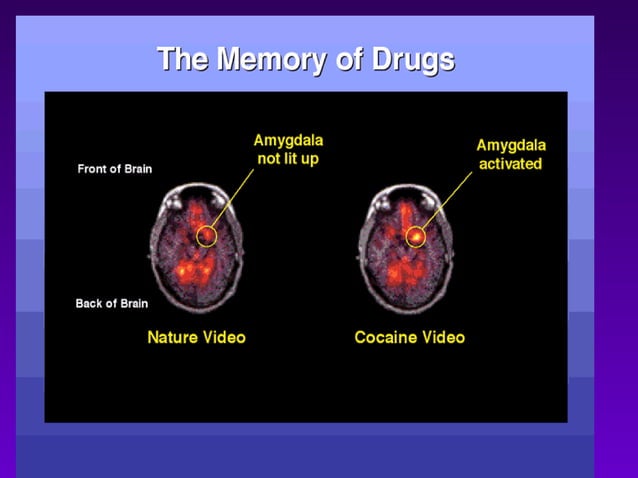 Drugsandthe Brain Part2 Addiction | PPT