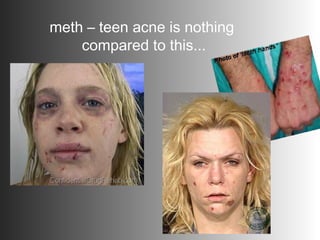 Drugs are bad chalkduster | PPT