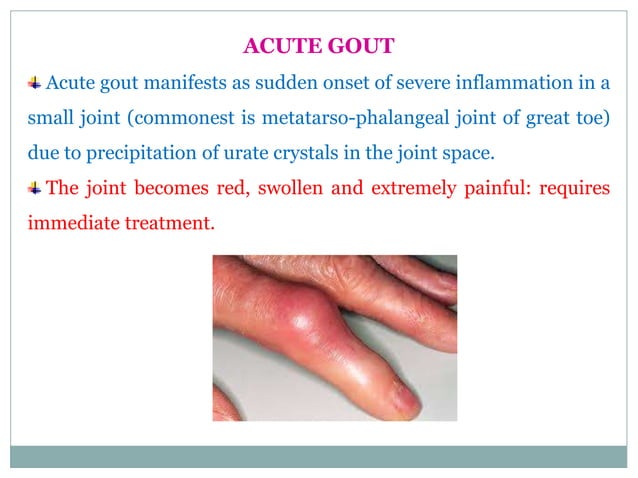 Drugs for Gout ( Acute and Chronic gout) | PPTX
