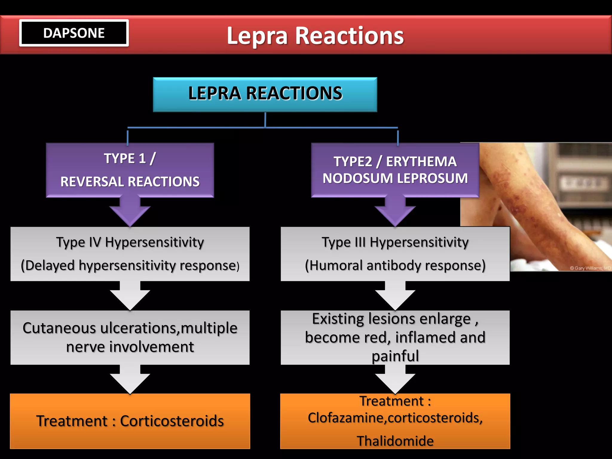 Drugs for leprosy | PDF