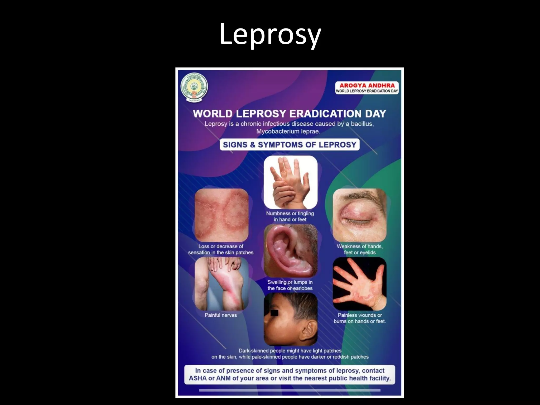 Drugs for leprosy | PDF