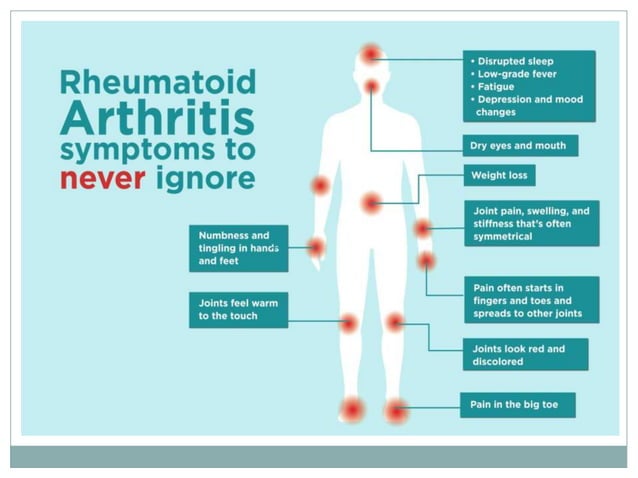 Drugs for Rheumatoid Arthritis | PPTX | Chemistry | Science