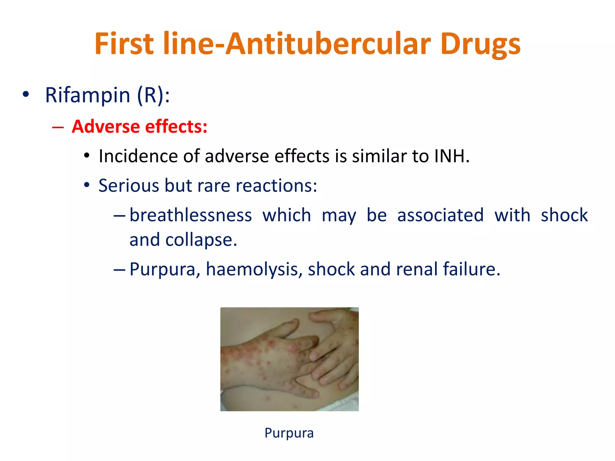 Drugs for tuberculosis | PPTX