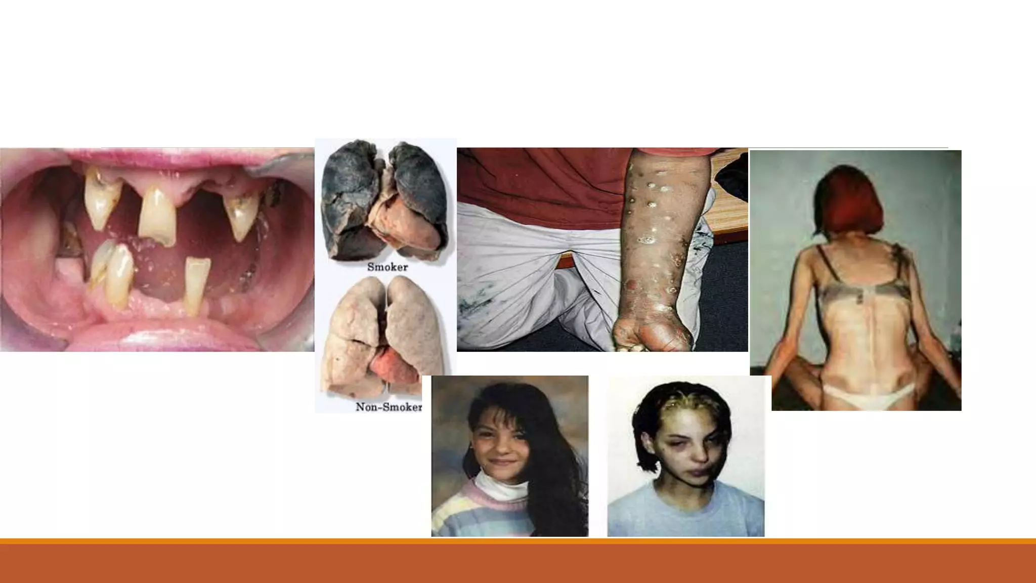 Drugs & substance abuse at workplace | PPTX