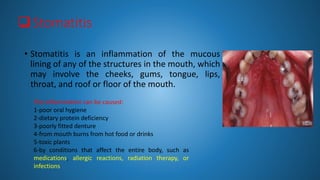 Drugs that induce oral diseases | PPTX