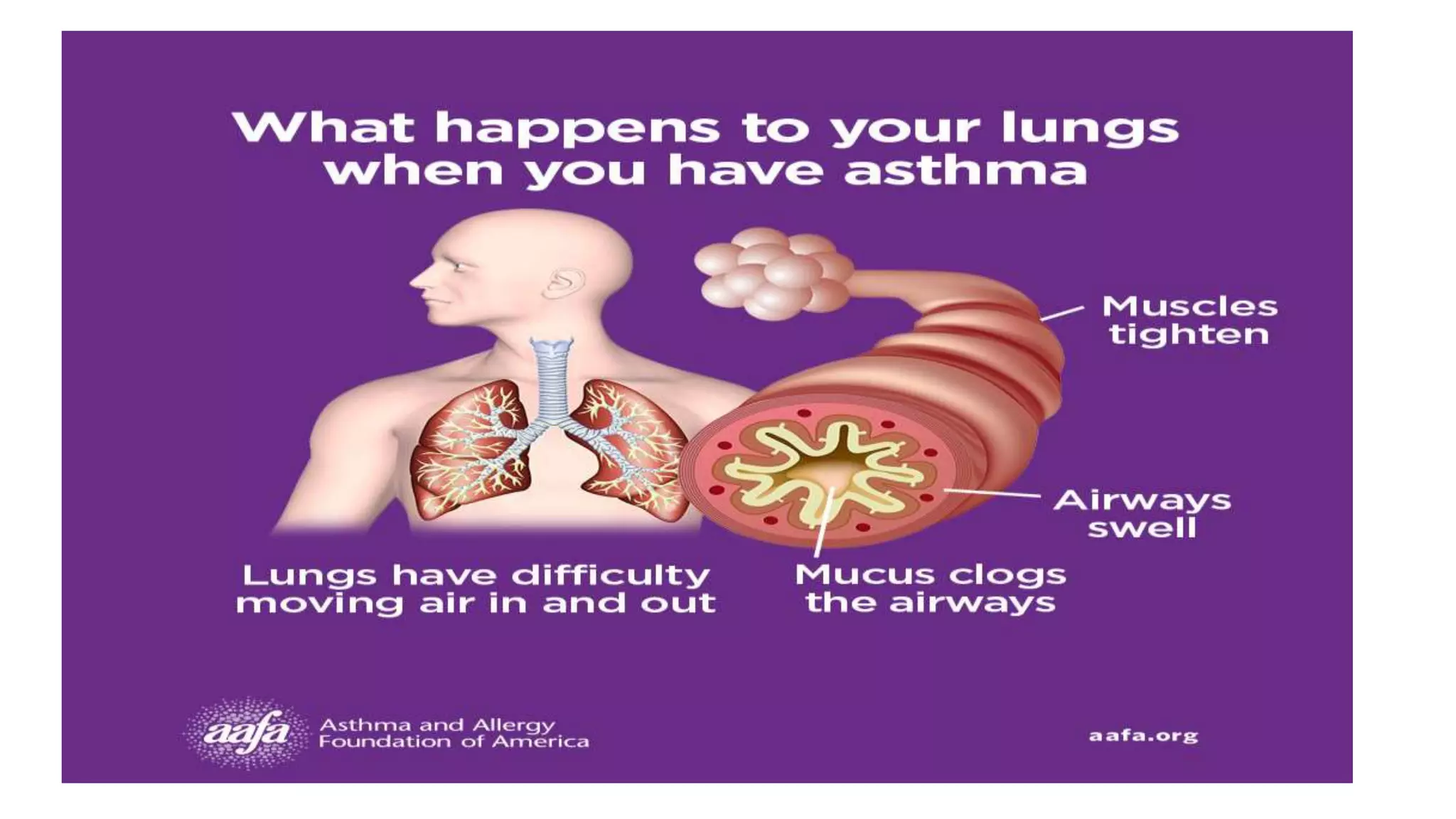 Structure and mechanism of action of Drugs for the treatment of asthma.pptx
