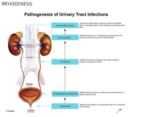 DRUGS USED FOR UTI.pptx